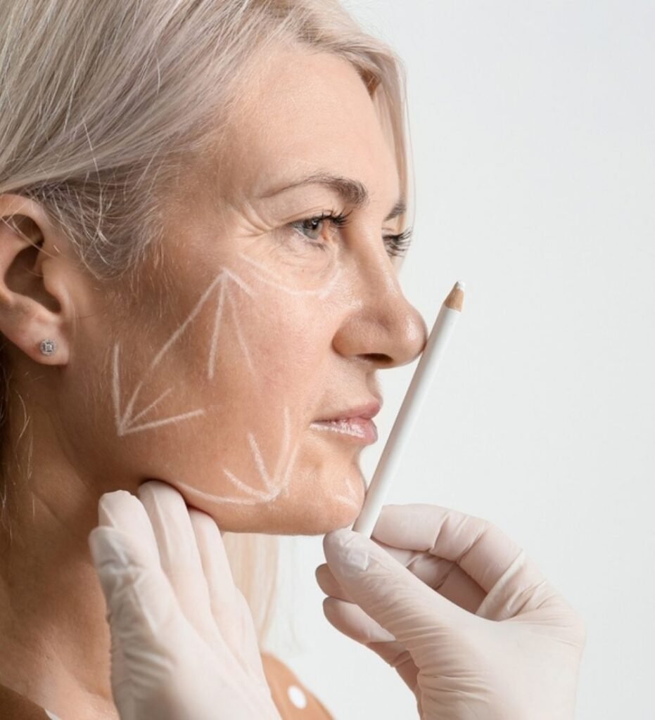 Facelift in Turkey - Op. Dr. Gökhan Özerdem